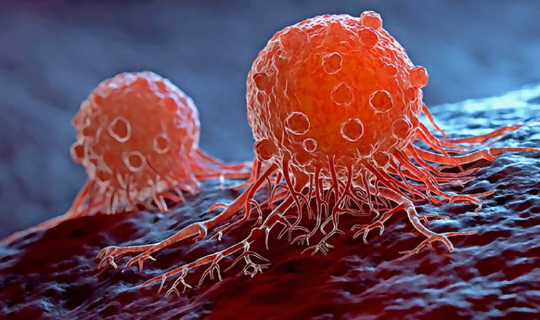 Desarrollan un nuevo modelo de IA que detecta el origen del cáncer de ...